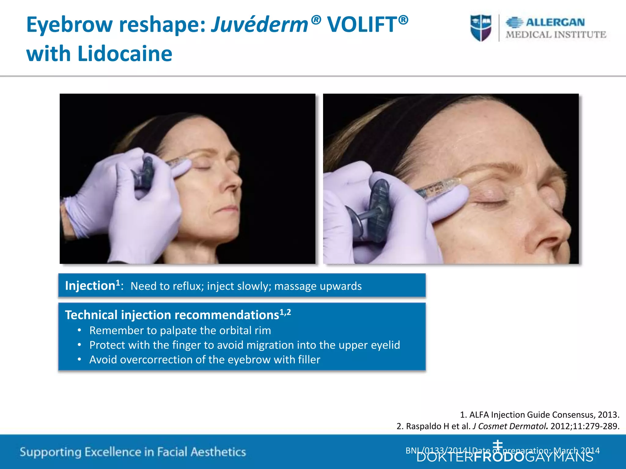Training for periorbital and upper face treatment with botox and ...