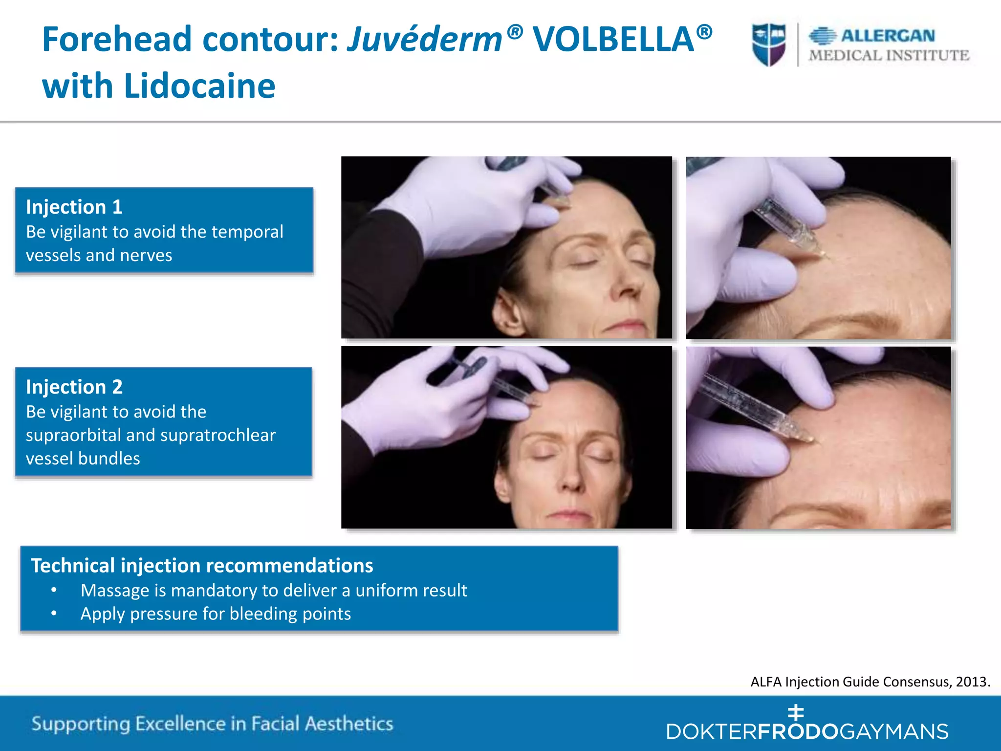 Training for periorbital and upper face treatment with botox and ...