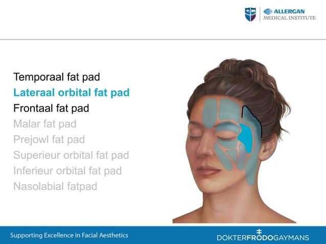 Training for periorbital and upper face treatment with botox and ...