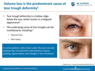 Training for periorbital and upper face treatment with botox and ...