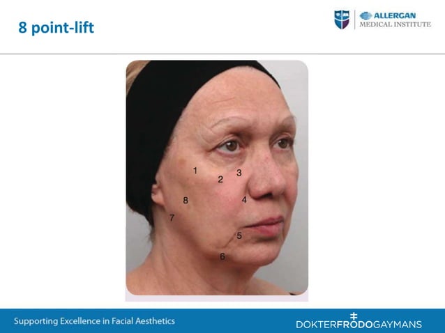 Training for periorbital and upper face treatment with botox and ...