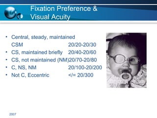 2014 Basic Pediatric Vision Examination | PPT