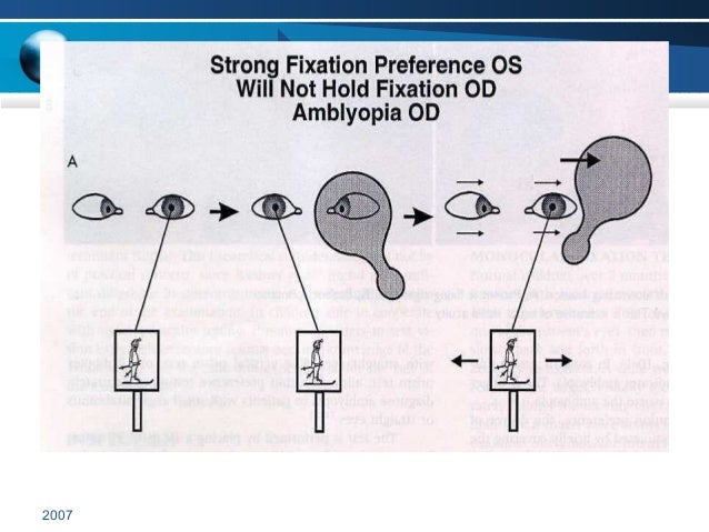 2014 Basic Pediatric Vision Examination