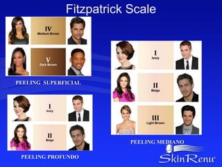 Tratamiento de Hiperpigmentacion com Estrategias de Peeling Combinadas ...