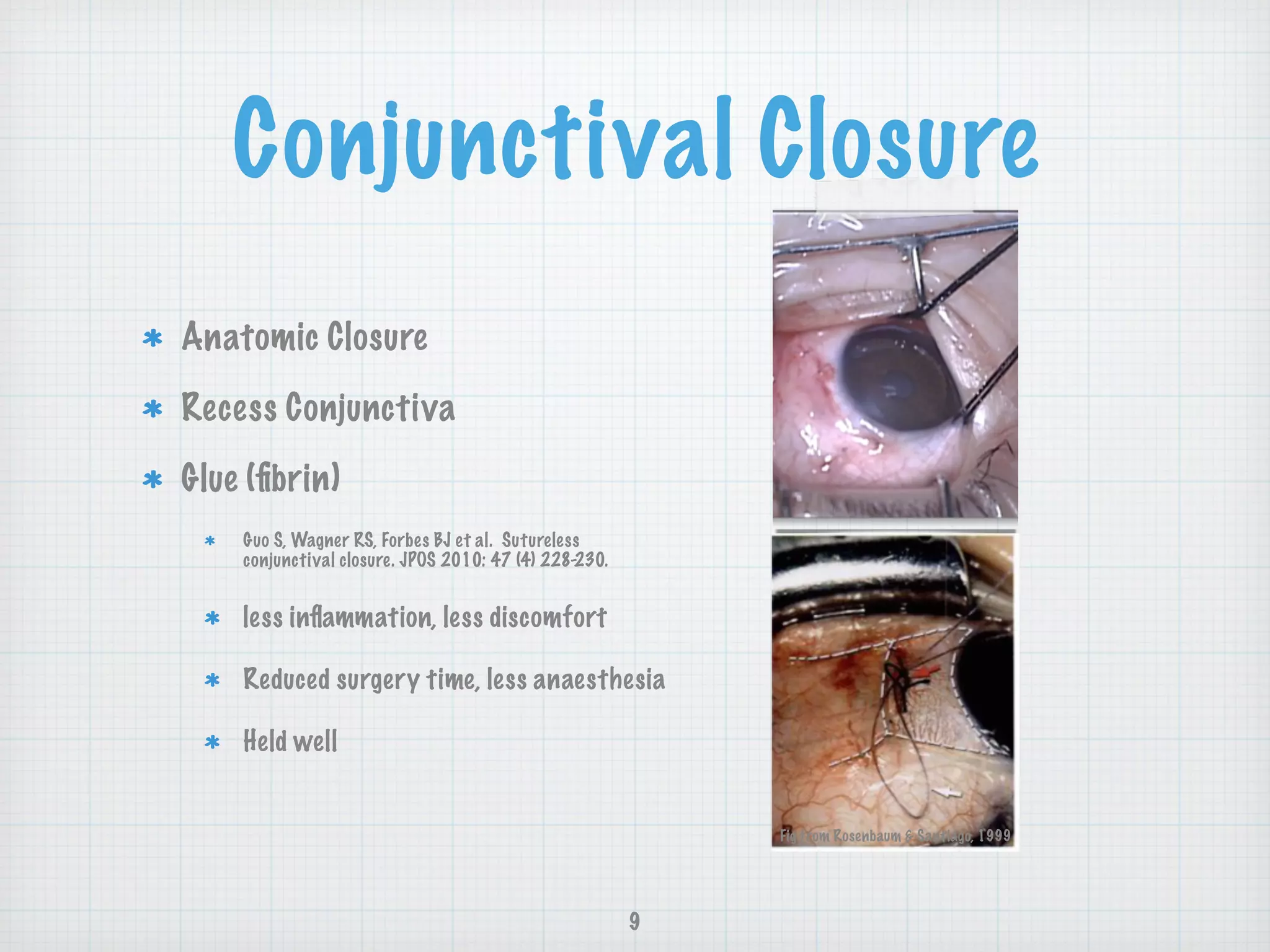 2014 strabismus surgery slmc | PDF