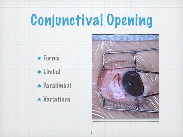 2014 strabismus surgery slmc