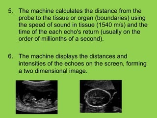 Innovative Applications and Techniques in Acoustic Emission Monitoring ...