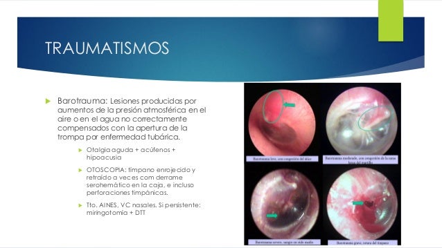 (2015-04-16) Otoscopia (PPT)