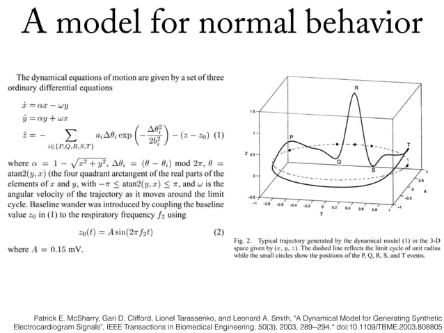 Understanding ECG signals in the MIMIC II database | PDF
