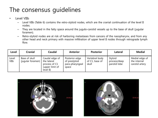 2015 06-25 delineation of the neck node levels for head and neck ...