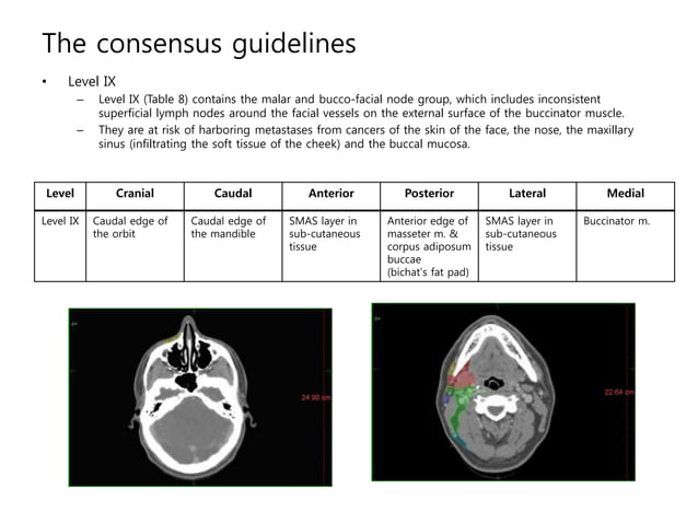 2015 06-25 delineation of the neck node levels for head and neck ...