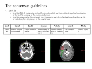 2015 06-25 delineation of the neck node levels for head and neck ...