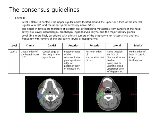 2015 06-25 delineation of the neck node levels for head and neck ...