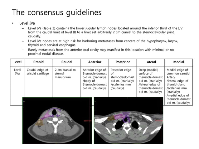 2015 06-25 delineation of the neck node levels for head and neck ...