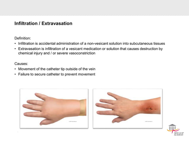 2015-09-18_IV_therapy_and_IV_access_Part_2.pptx