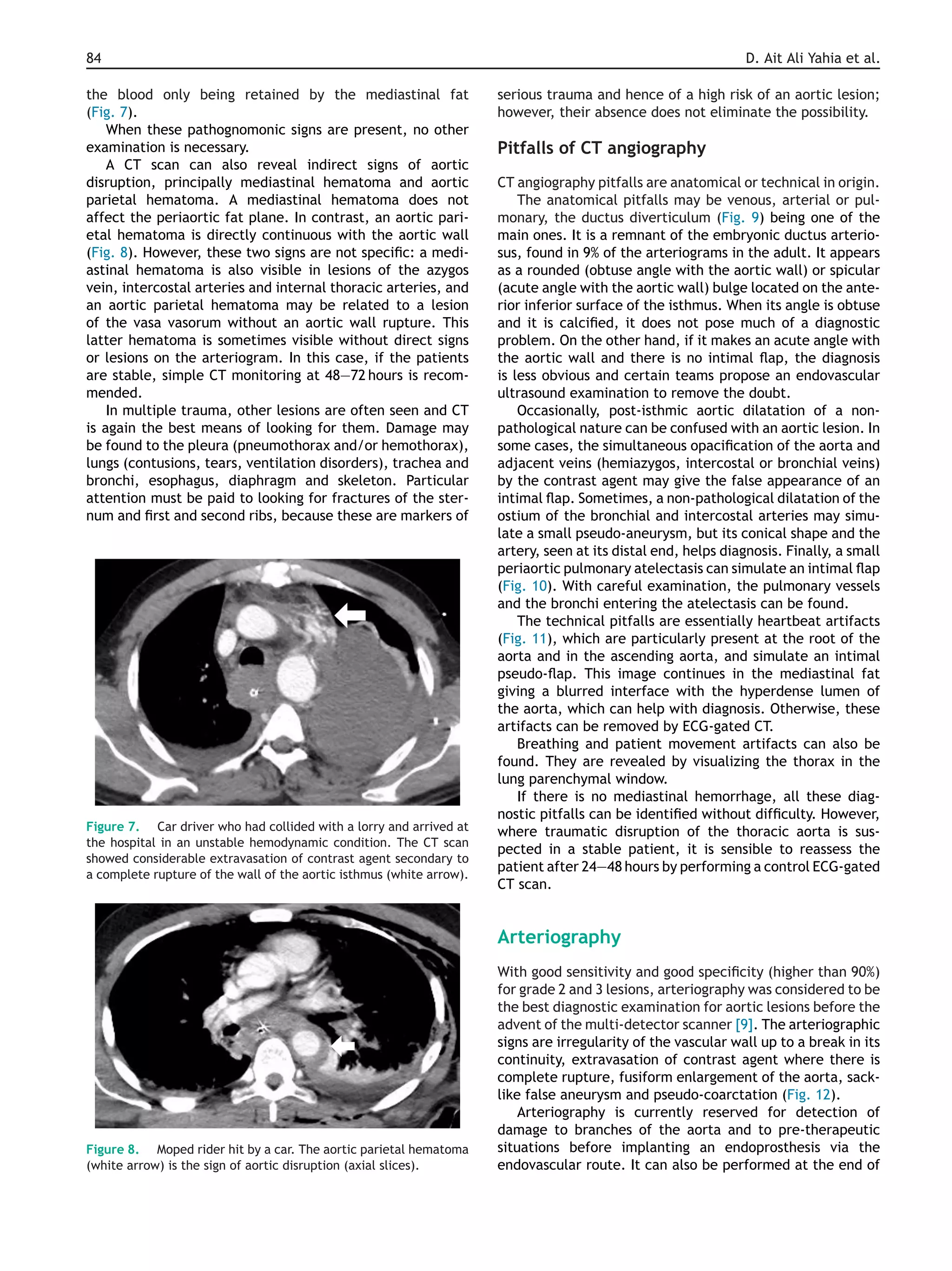 2015 Imaging of thoracic aortic injury | PDF