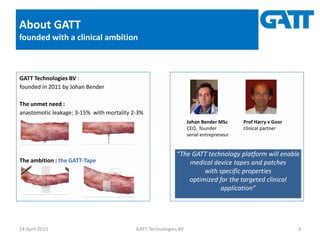20150402 smb inno boot gatt | PDF