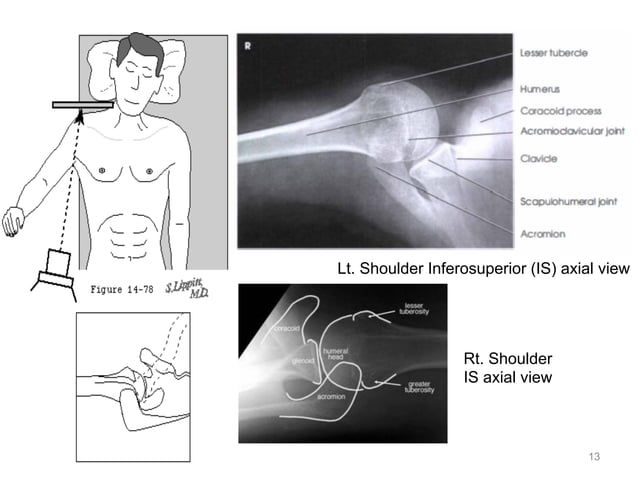 Emergency Radiology: Shoulder & Upper Extremities | PPT