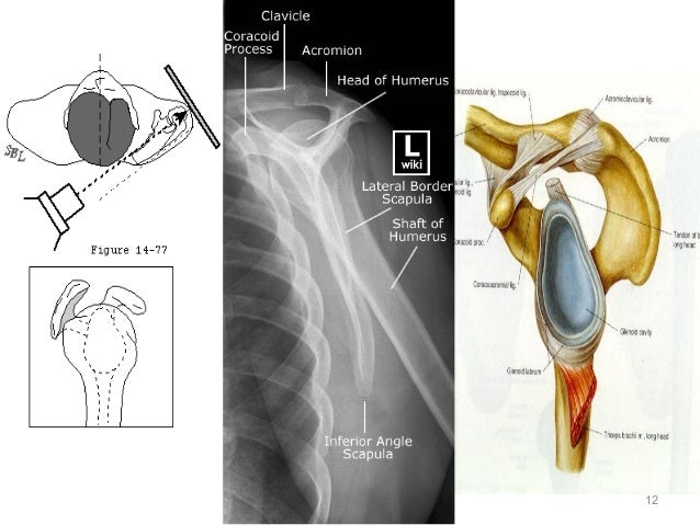 Emergency Radiology: Shoulder & Upper Extremities