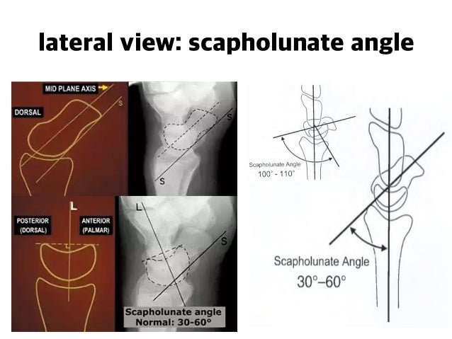 Emergency Radiology: Shoulder & Upper Extremities