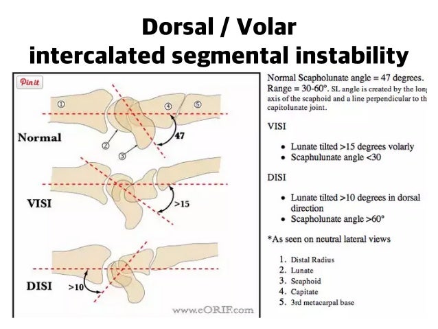 Emergency Radiology: Shoulder & Upper Extremities