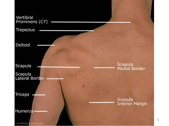 Emergency Radiology: Shoulder & Upper Extremities