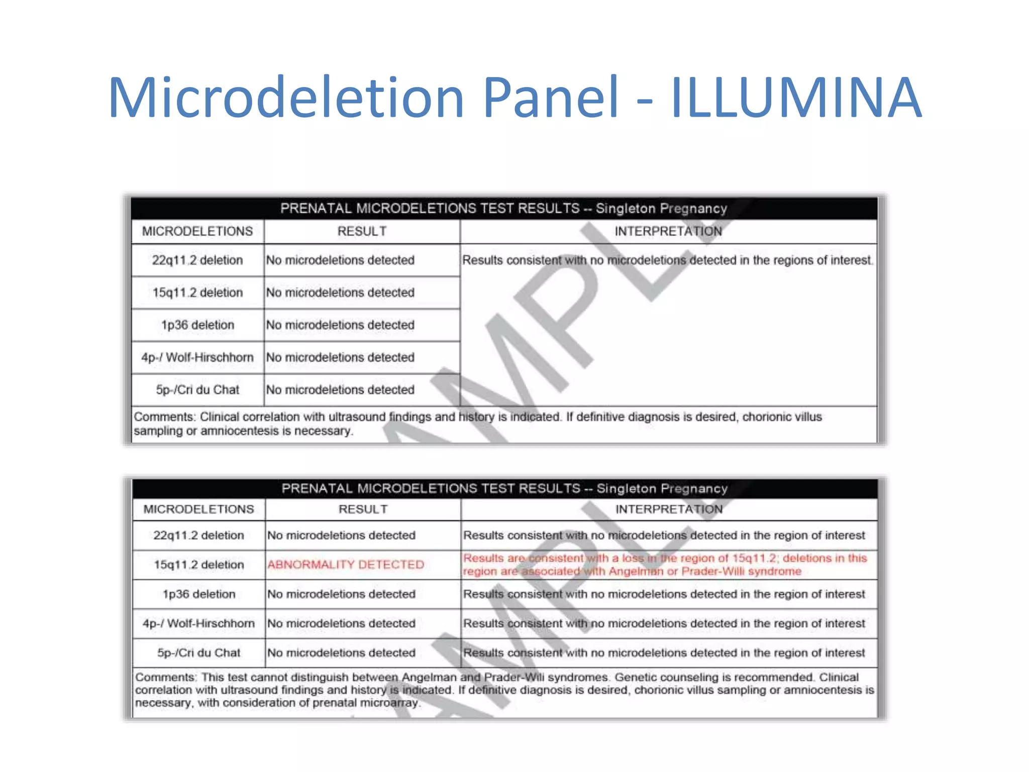 20150918 - Y Yuval - NIPT for Microdeletions & Single Gene Disorders | PPT