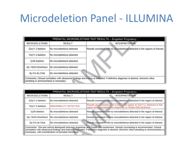20150918 - Y Yuval - NIPT for Microdeletions & Single Gene Disorders | PPT