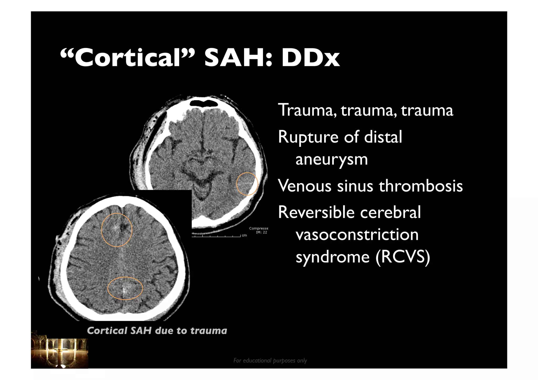 Neuro-imaging in Emergency Conditions | PDF