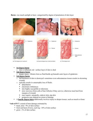 2015 a&p integumentary handout | PDF | Skin and Dermatology | Diseases ...