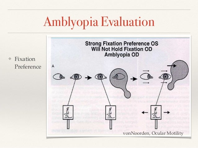 2015 Strabismus and Amblyopia