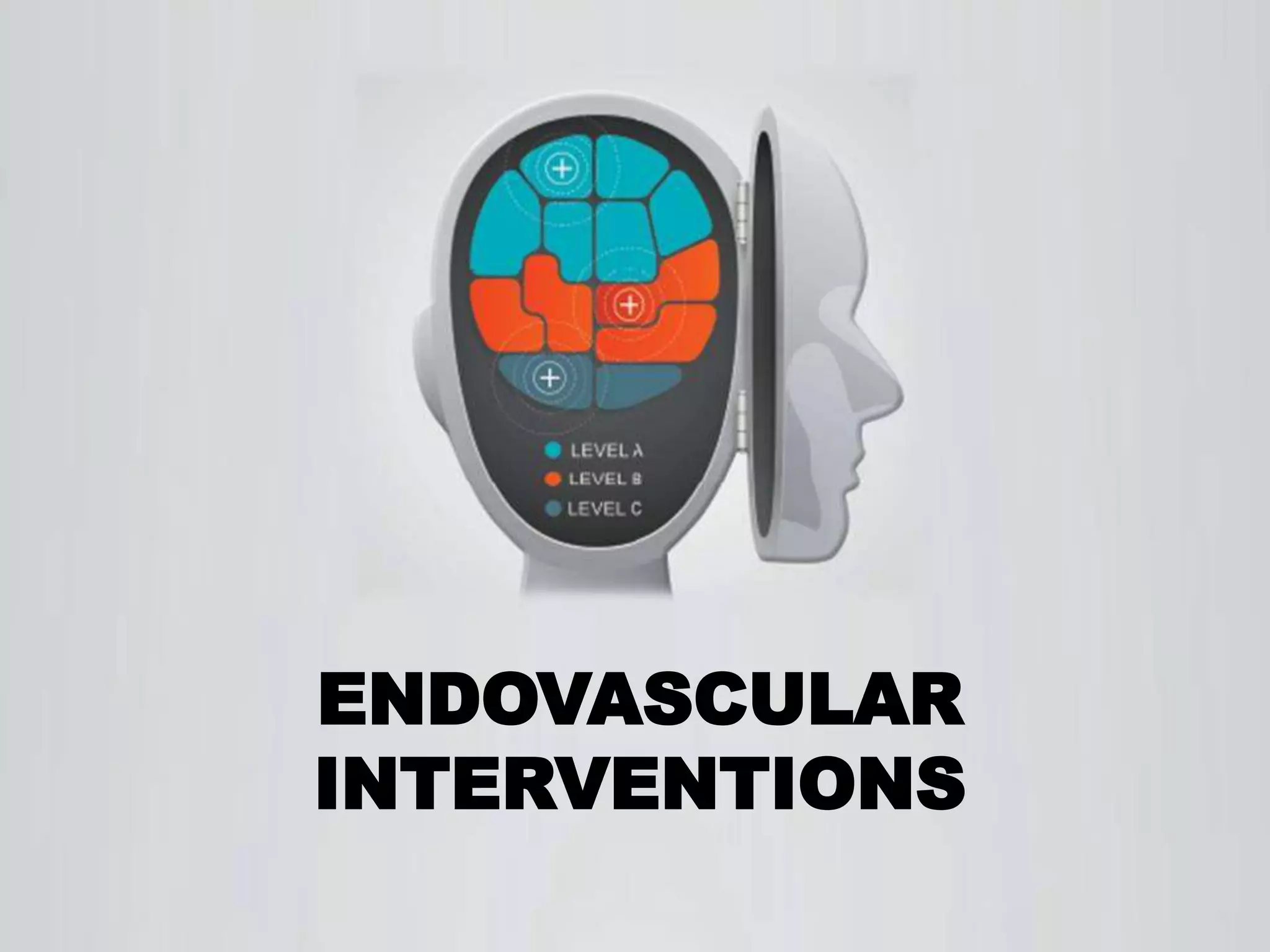 2015 AHA/ASA Focused Update Guidelines for Acute Ischemic Stroke ...