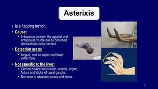 Asterixis