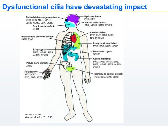 Ciliopathy Alliance - Research Update