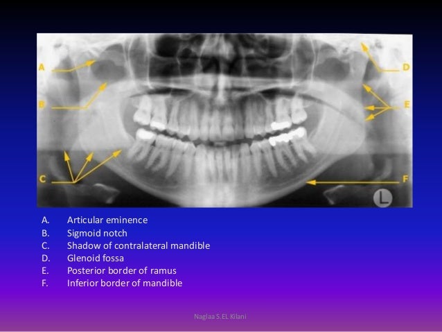 2015 radiology revision