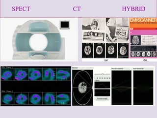 SPECT/CT: HOW Much Radiation Dose CT Constitute | PPTX