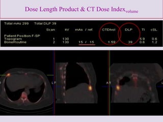 SPECT/CT: HOW Much Radiation Dose CT Constitute | PPT