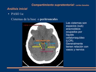 2015 supratentorial i tc | PDF