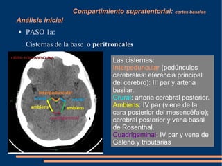 2015 supratentorial i tc | PDF