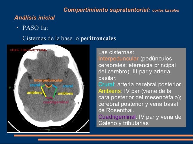 2015 supratentorial i tc