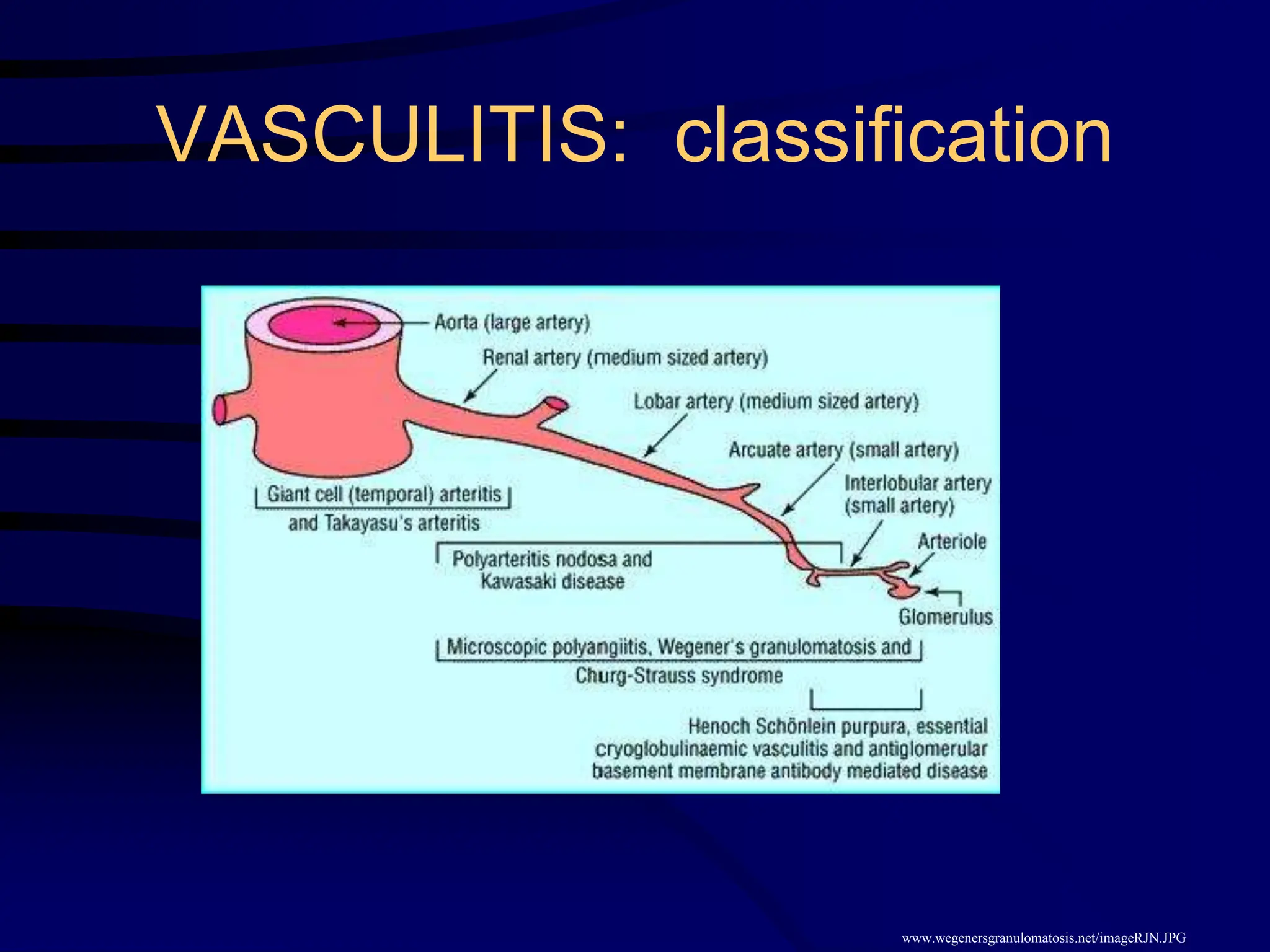 2015 mangement of Systemic Vasculitis.ppt