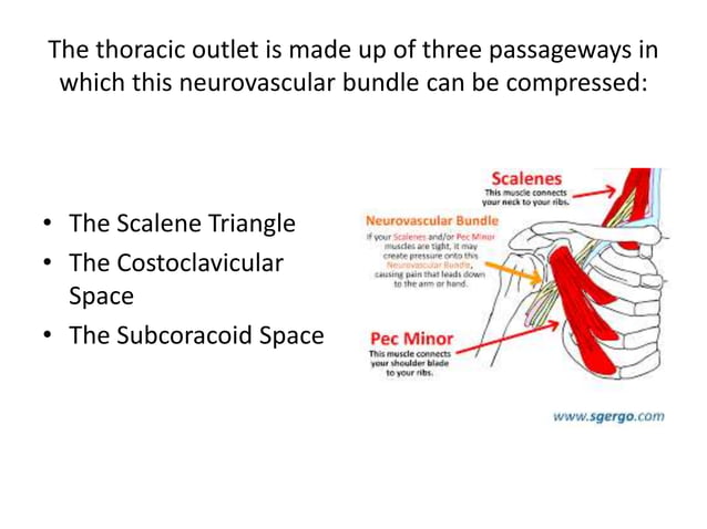The Integrated Spring-Mass Model Approach to Treating Thoracic Outlet ...