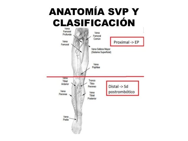 (2016 10-20)trombosis venosa profunda(ppt)