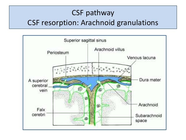 2016.03.16 csf pathway abnormalities