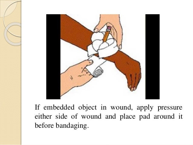 2016.04.27 first aid in the workplace 1 bcm