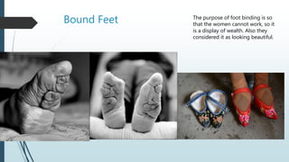 Chinese Cinderella Foot Binding