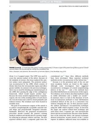 2016 heinz-two-step reconstruction of non-marginal auricular defects | PDF