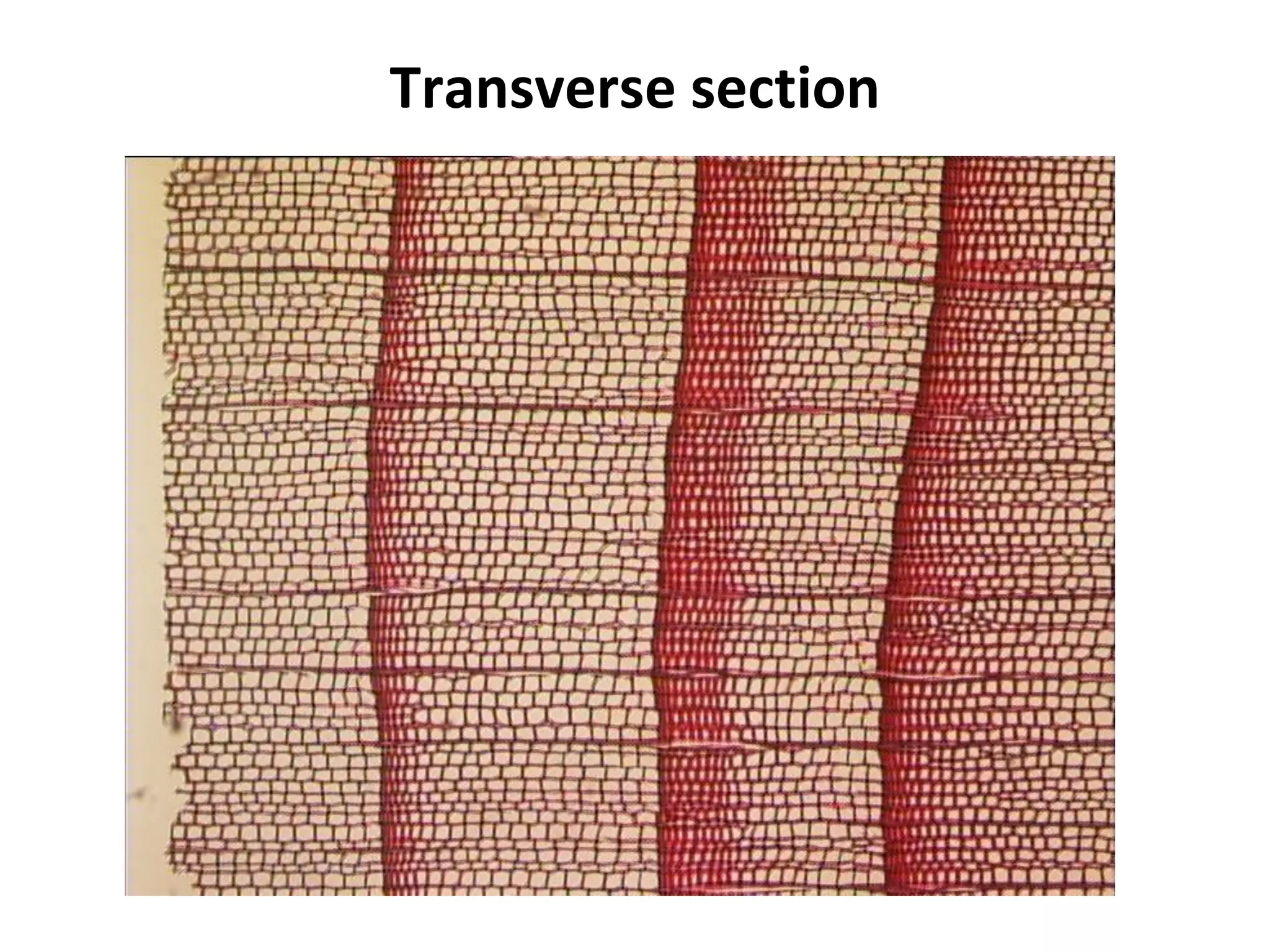 Wood anatomy and structure , wood and its products | PDF