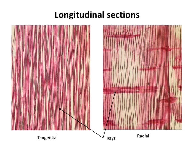 Wood anatomy and structure , wood and its products | PDF | Woodworking ...