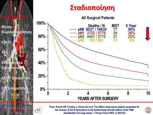Mediastinoscopy - ebus - pet-ct (kleontas) - Μεσοθωρακοσκόπηση ...